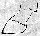 Corrective Trimming and Shoeing in Contracted Tendons of Foals